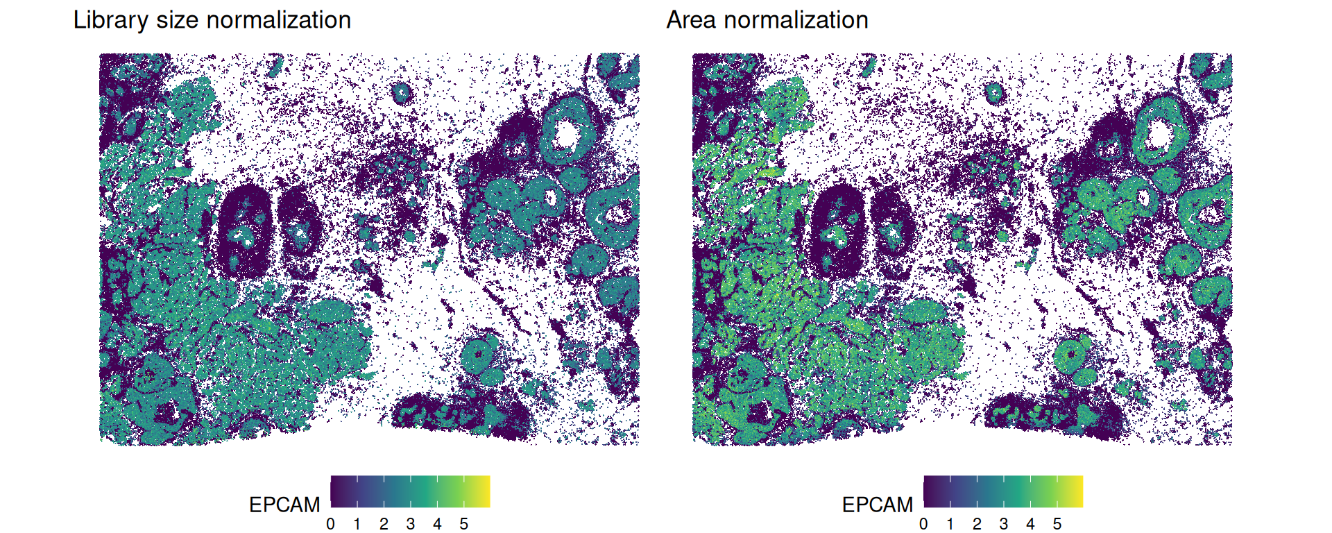 26 Normalization – Orchestrating Spatial Transcriptomics Analysis with ...