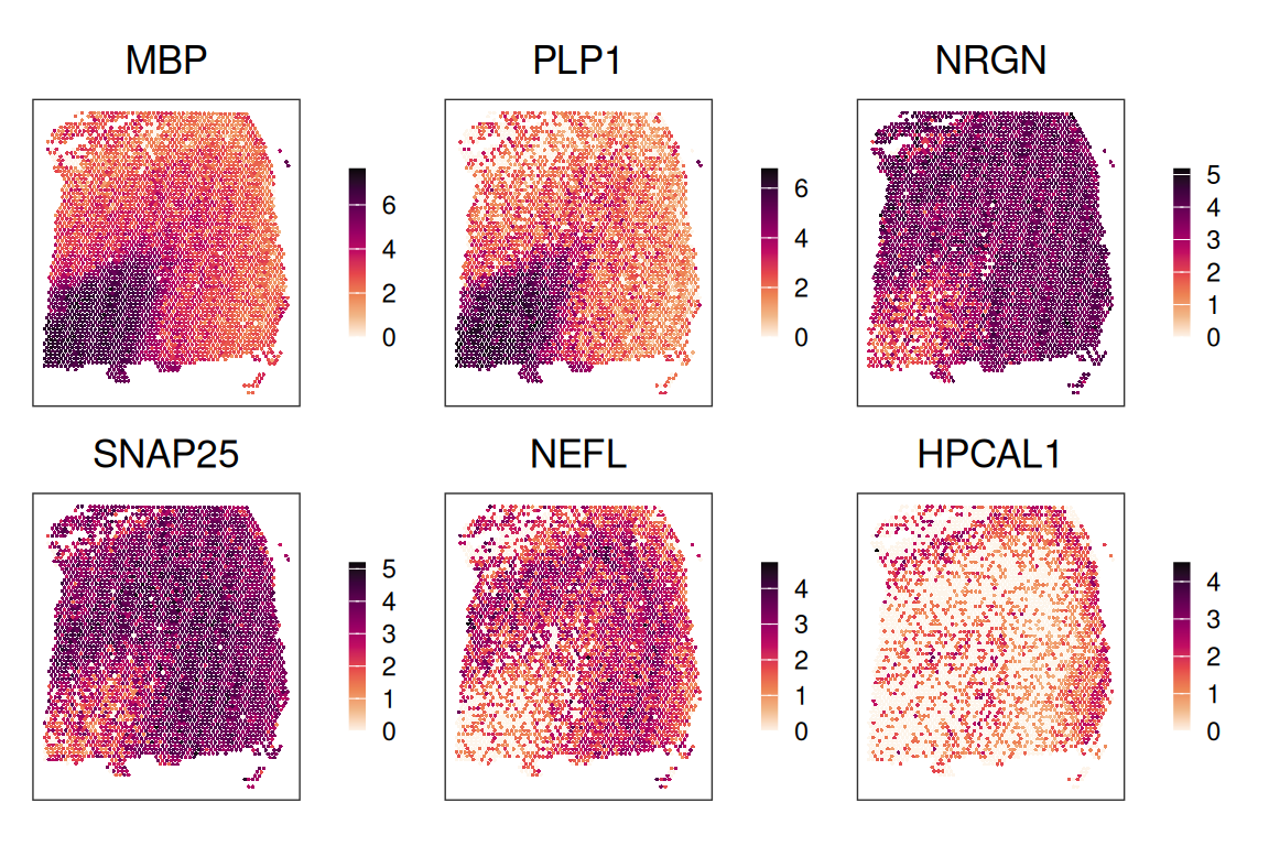 11 Intermediate processing – Orchestrating Spatial Transcriptomics ...
